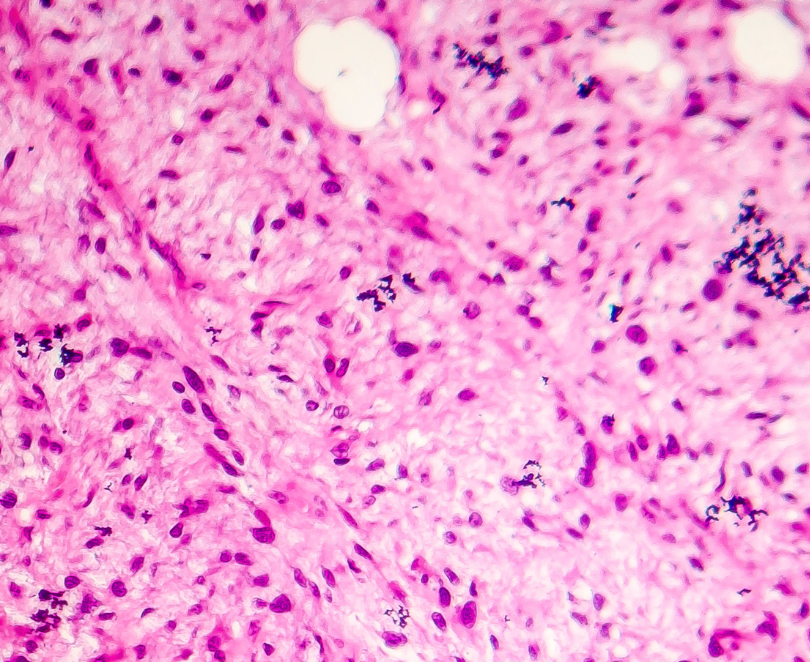 BioAro : Precision Health