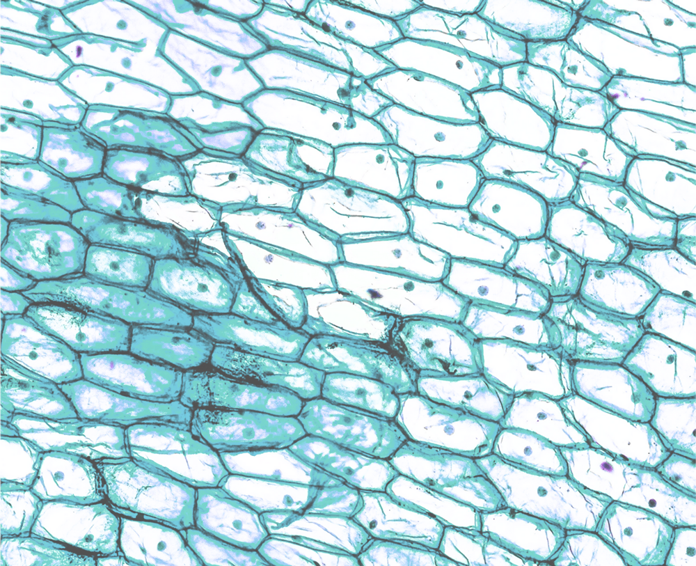 BioAro : Precision Health